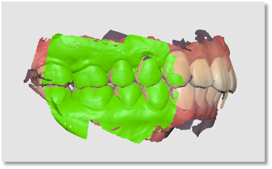 How do I manually align the bite? – MegaGen Digital Help